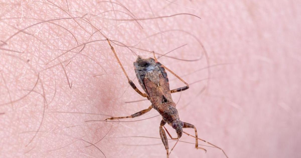 Kissing Bug Bites Victims and Spreads Chagas Disease Through Its Poop ...