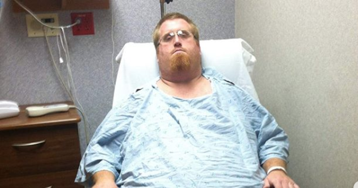 An Order of Chinese Food Kickstarted This Man's Dramatic 350-Pound ...