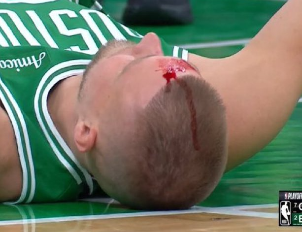 Basketball star suffers serious head injury as blood gushes out from ...
