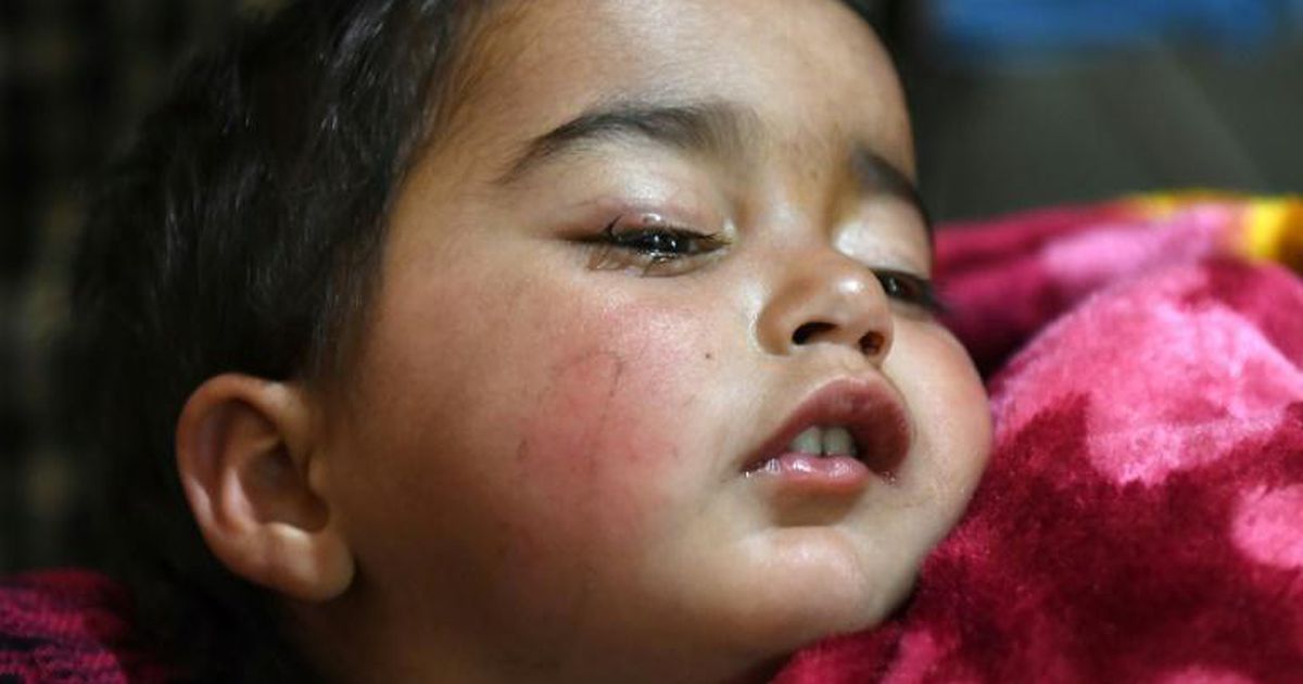 Indian pellet guns in Kashmir kill, blind and enrage | Pulse Ghana
