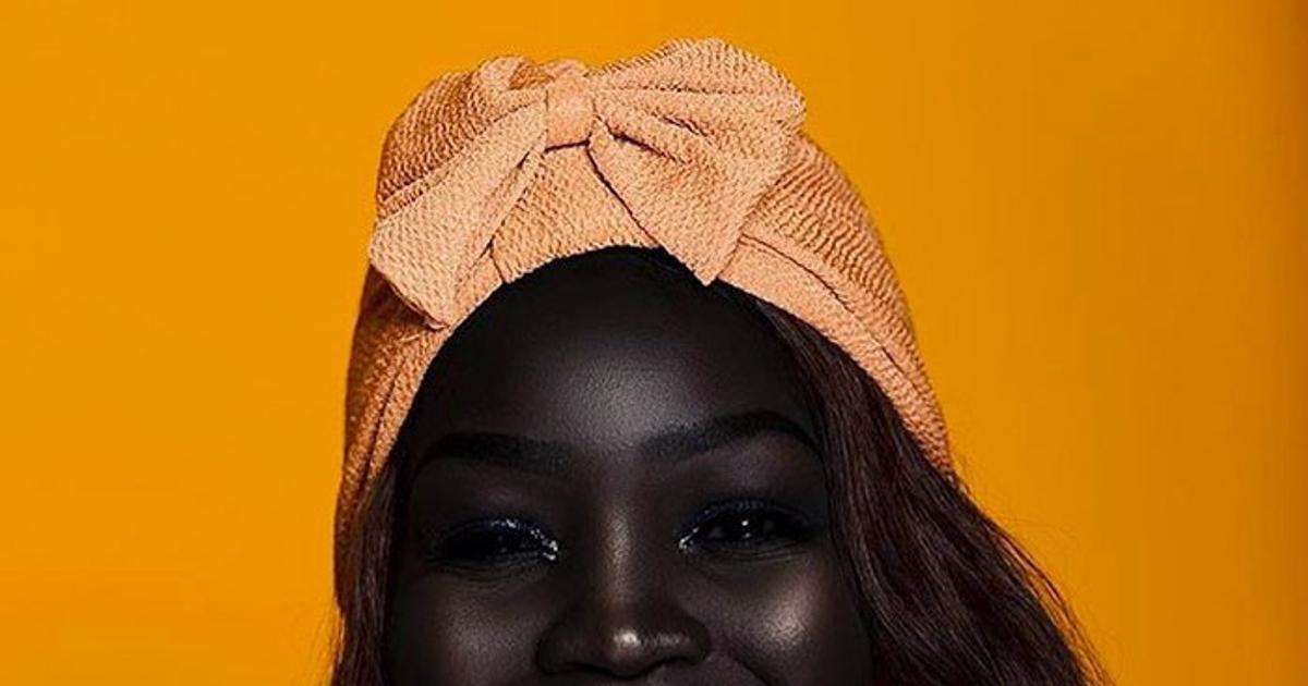 People with darker complexions have these advantages over those with ...