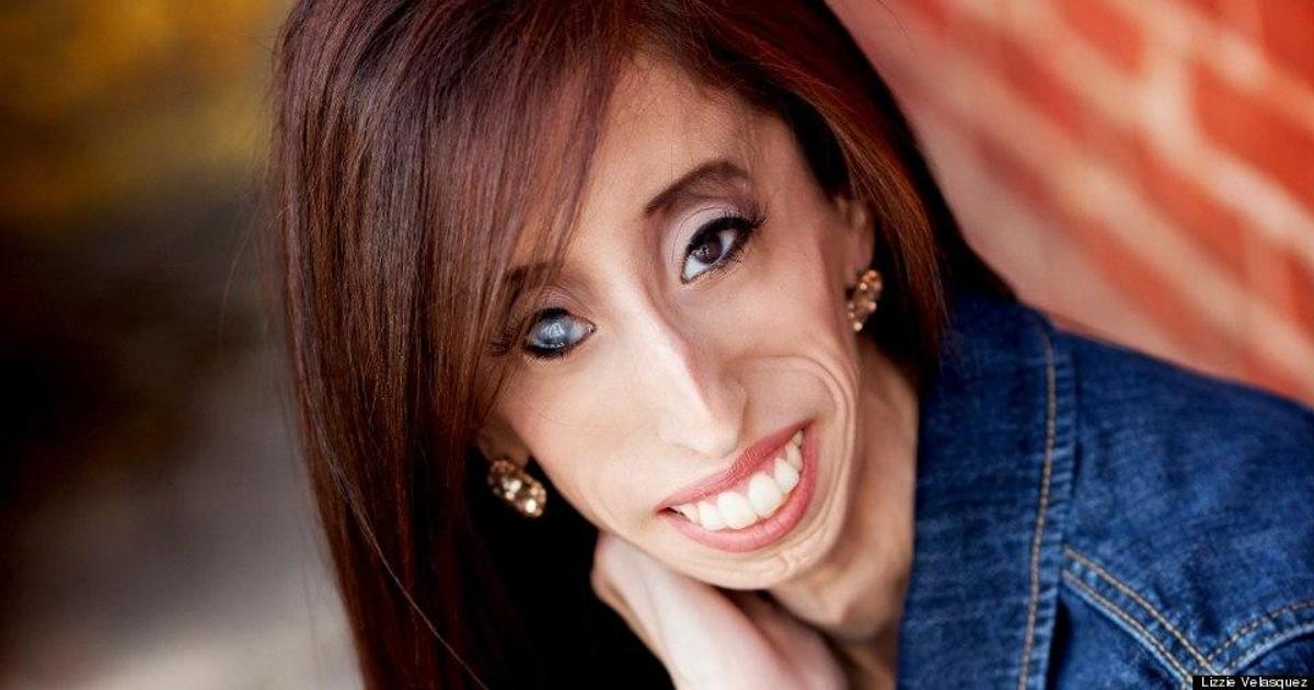Once dubbed the 'world's ugliest woman,' Lizzie Velazquez shuts down ...
