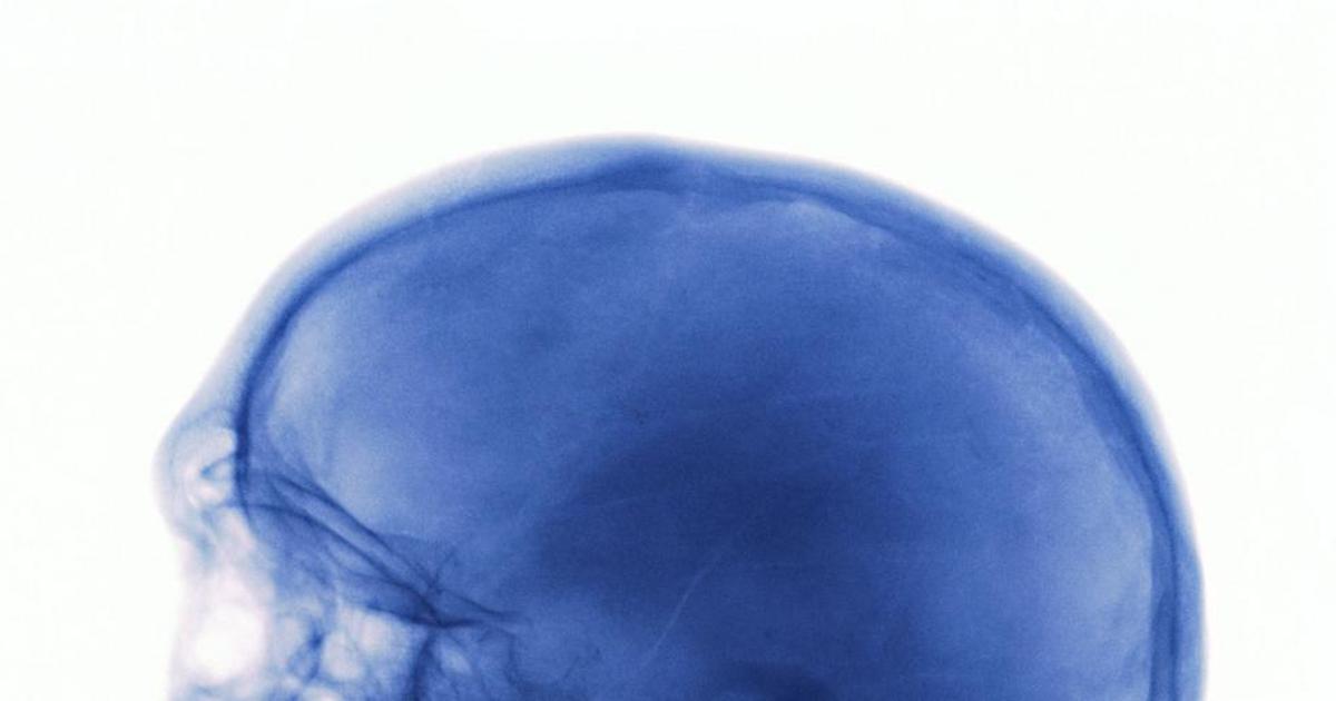 I Just Hit My Head Really Hard. Should I Freak Out? | Pulse Nigeria