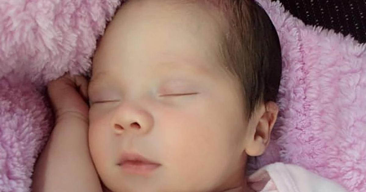 A Colombian Woman Gave Birth To A Baby With A Twin Growing Inside Her ...