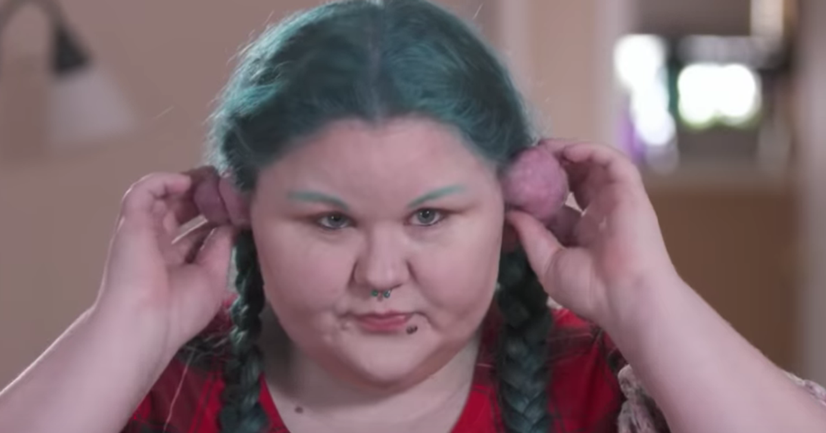 Dr. Pimple Popper Treats a Patient With Massive Keloids on Her Ears in ...
