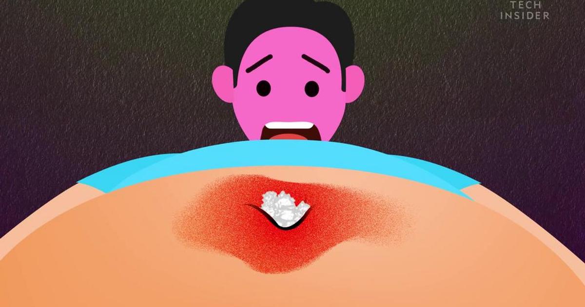 A biologist once made cheese with belly-button bacteria. Here's how ...