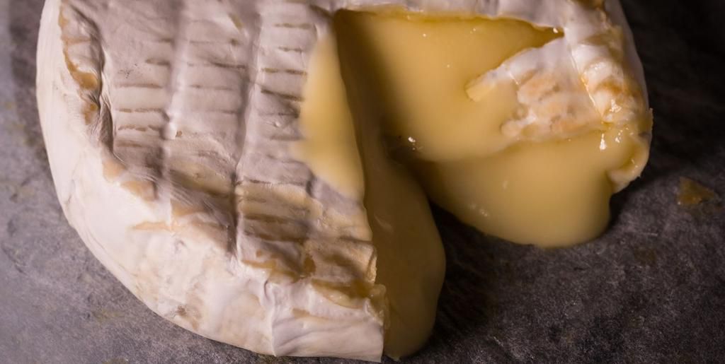 Dr. Pimple Popper Squeezes Melted Cheese From A Steatocystoma In New ...