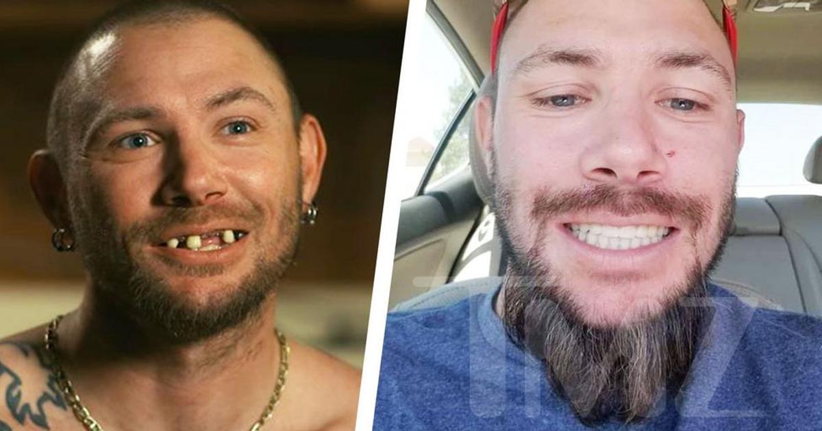 Here’s What 'Tiger King' Star John Finlay Looks Like With a New Set of ...
