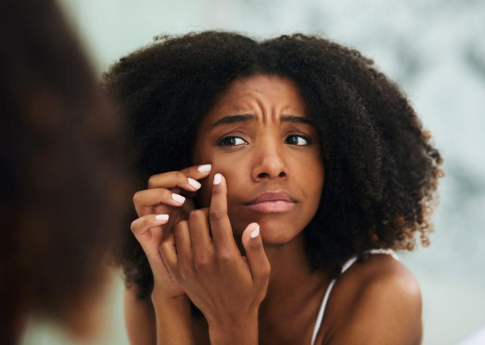 How do you get rid of pimples in 2 hours? | Pulse Nigeria