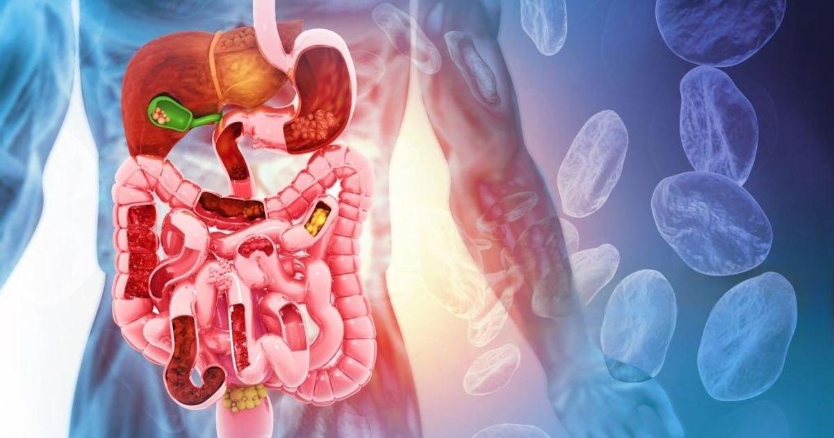 8 effective natural laxatives for stomach relief | Pulse Nigeria