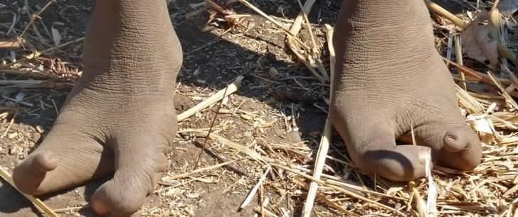 The African tribe in Zimbabwe with odd toes | Pulse Nigeria