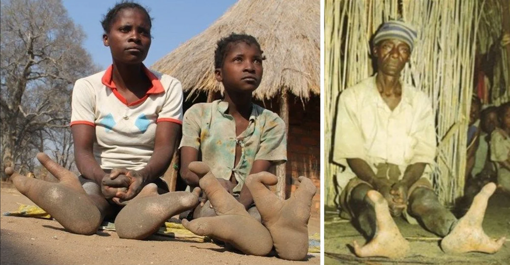 The African tribe in Zimbabwe with odd toes | Pulse Nigeria