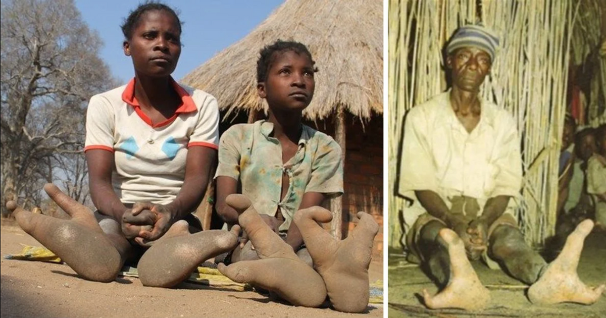 The African tribe in Zimbabwe with odd toes | Pulse Nigeria