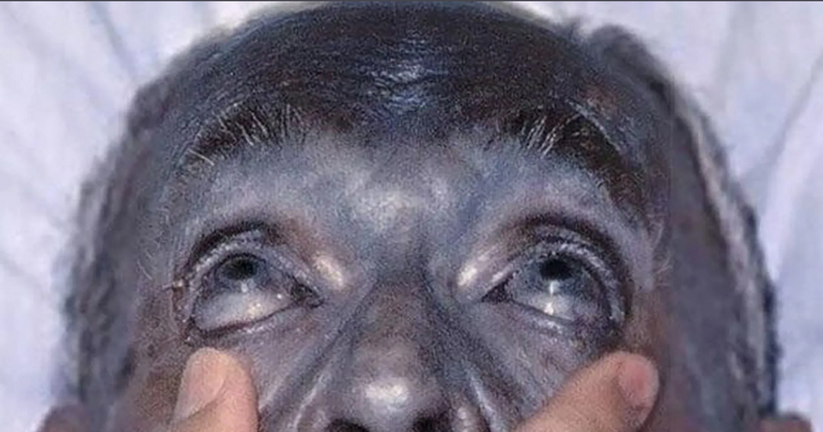 The strange story of the blue people of Kentucky | Pulse Nigeria