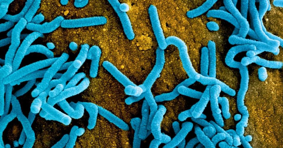 Marburg Virus: Likelihood of case importation high in Nigeria – NCDC ...