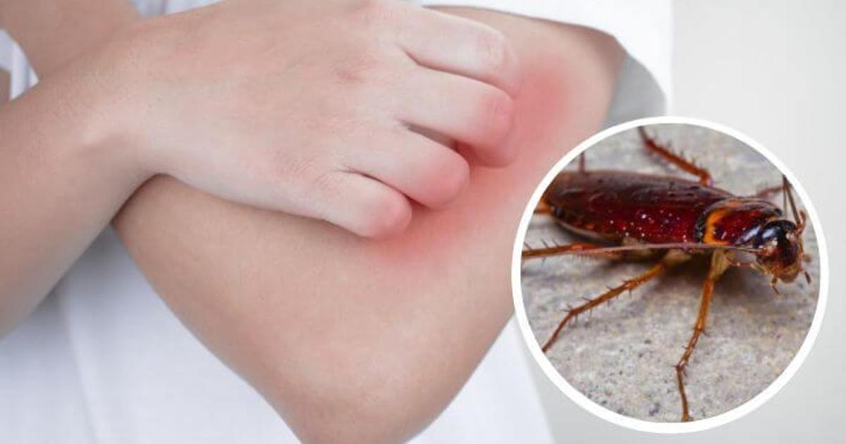 Do cockroaches bite and spread diseases? | Pulse Nigeria