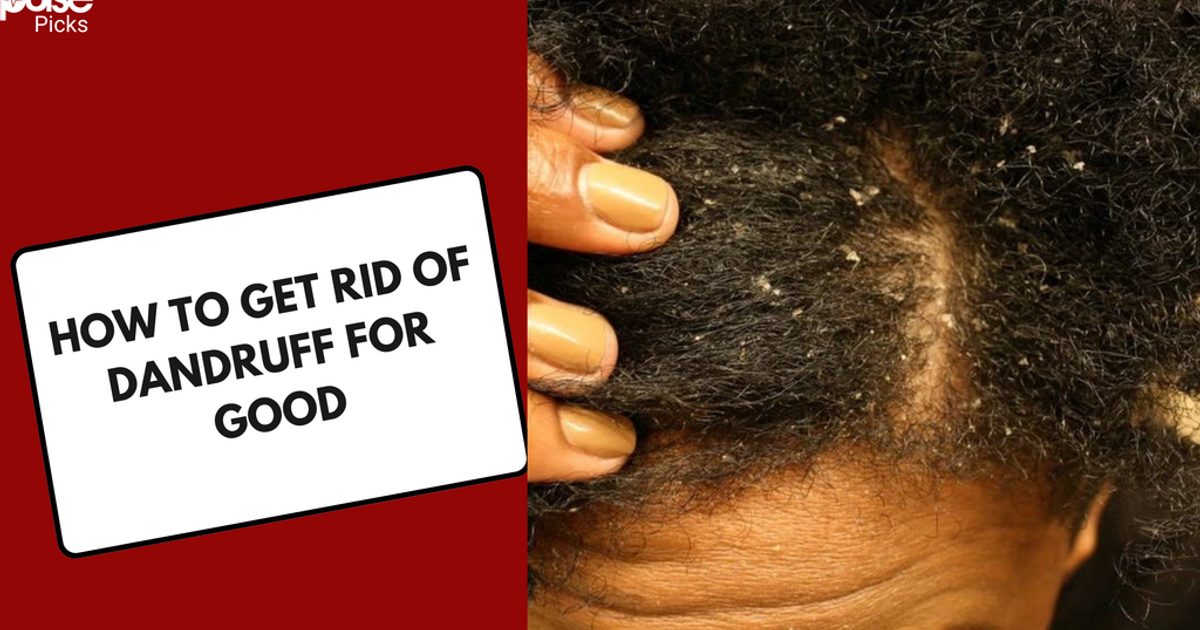 How to get rid of dandruff in your hair for good | Pulse Nigeria