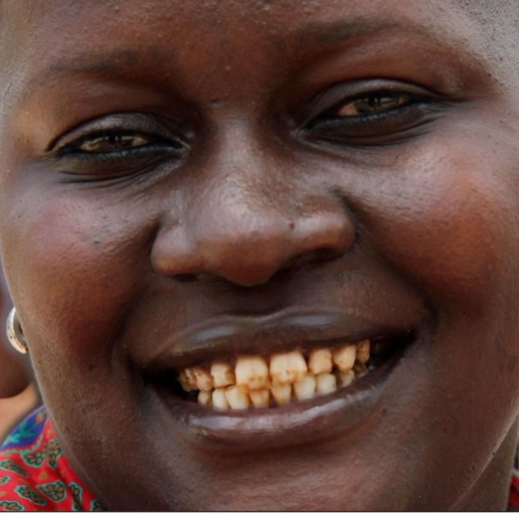 5 drinks that stain teeth and how to keep your teeth white | Pulse Nigeria