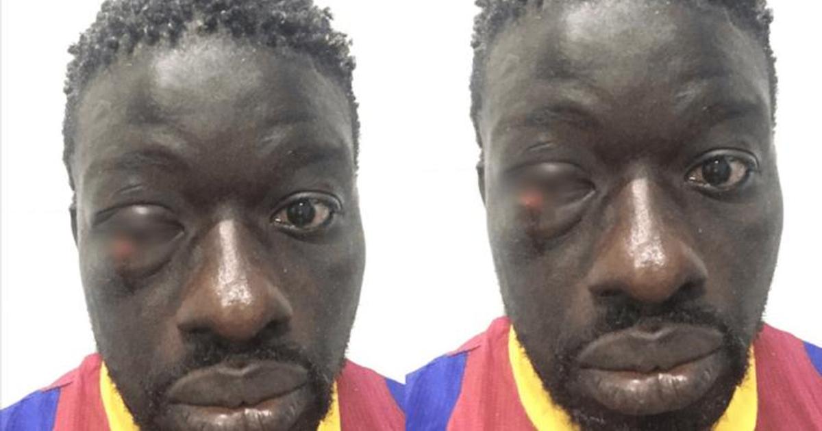 Zoss revient sur son retour raté | Senegal