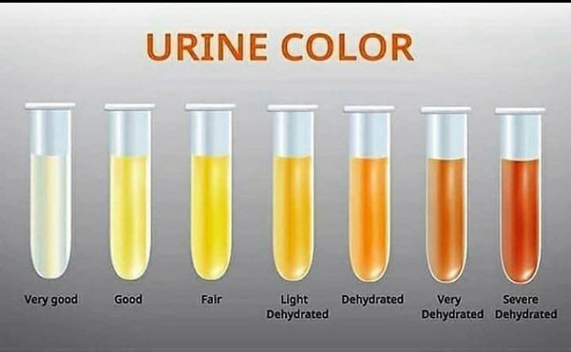 Pourquoi votre urine change-t-elle de couleur ? Voici ce que cela ...