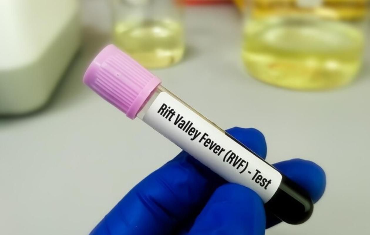 Fièvre de la Vallée du Rift : Comprendre le virus qui se transmet de l ...