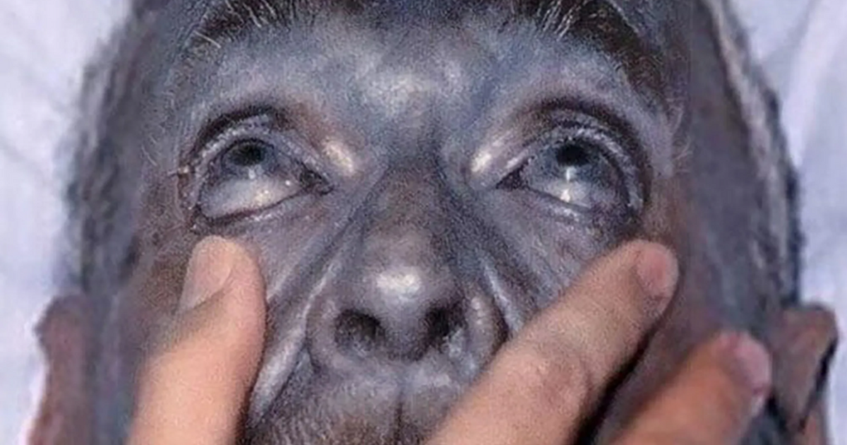 The strange story of the blue people of Kentucky | Pulse Uganda