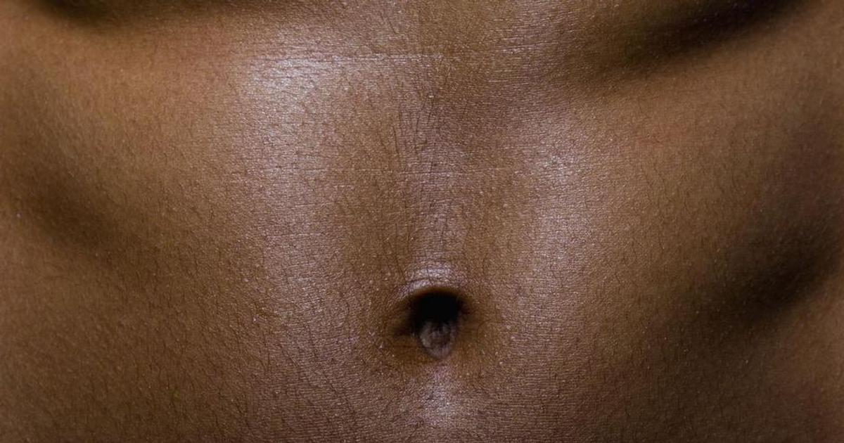 7 things your belly button says about your health | Pulse Uganda