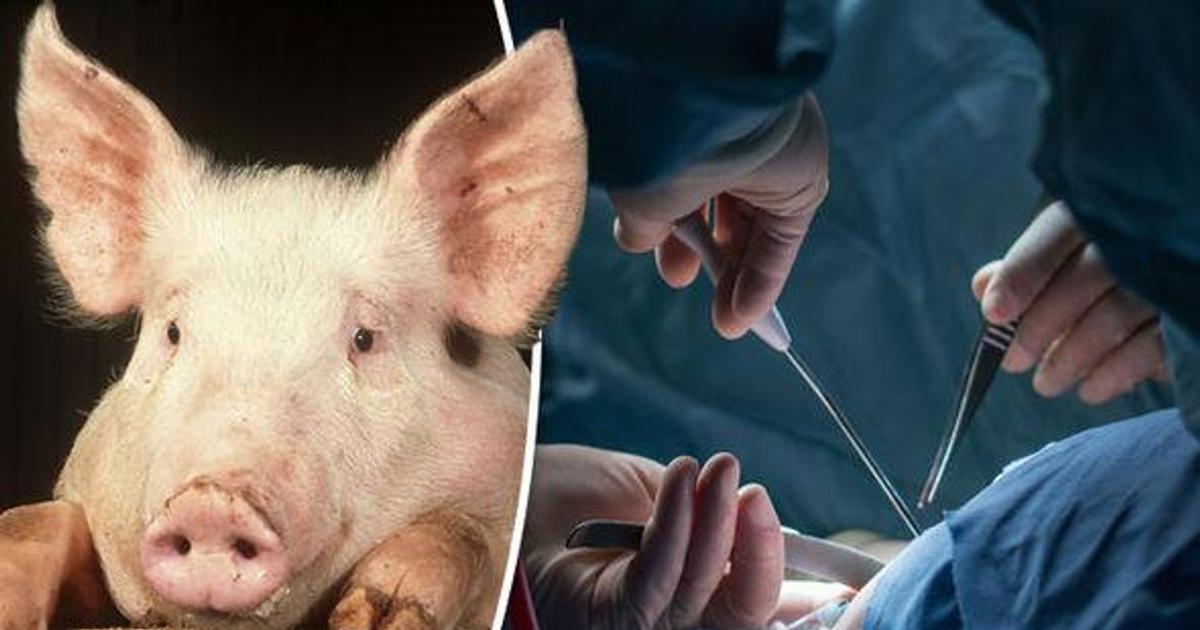 Man gets a new kidney from a pig in groundbreaking surgery | Pulse Uganda