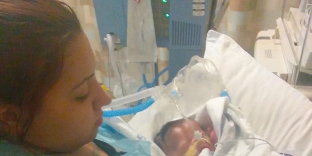 Texas Baby Born Without Skin Is Able To Be Held, Kissed By Mother After ...