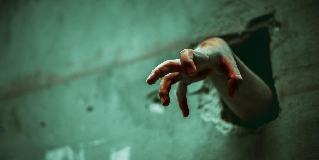 Dr. Pimple Popper Just Squeezed A Completely Intact 'Zombie' Cyst In ...