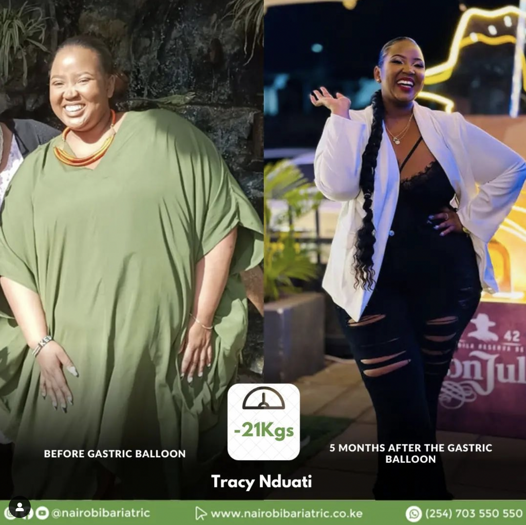 Tracy Nduati's inspiring 21 kg weight loss journey with the gastric balloon at Nairobi Bariatric ...